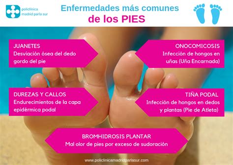 Podología Problemas comunes en los Pies Infografía