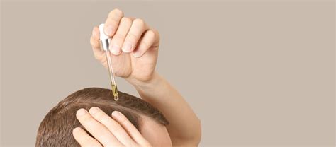 Perte De Cheveux Chez L Homme Causes Et Solutions