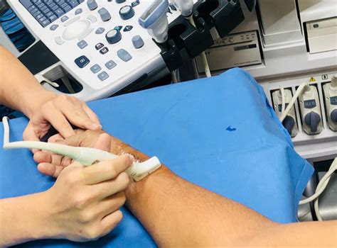 Desde 70 ECO Doppler Arterial Extremidades Superiores O