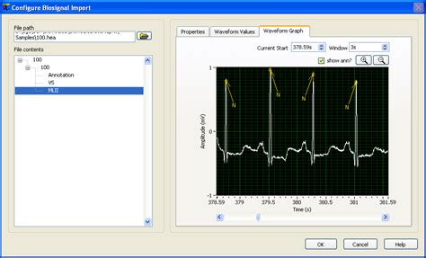 how to use ni biomedical startup kit 2 0 ecg feature extractor ni community