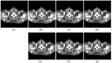 applied sciences free full text sparse view computed tomography reconstruction based on a