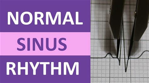 Normal Sinus Rhythm Nursing Made Easy On ECG EKG Heart Interpretation