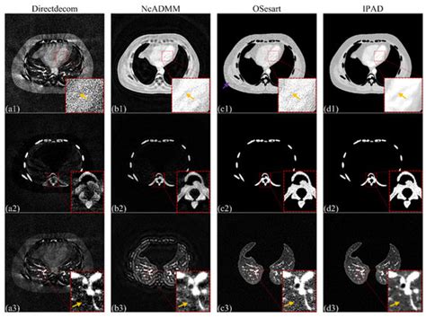 bioengineering free full text direct multi material reconstruction via iterative proximal
