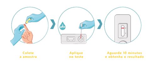Teste R Pidos Para Dengue Proxima