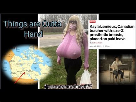 Kayla Lemieux Canadian Teacher With Z Size Prosthetic Breasts