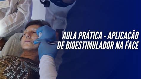 AULA PRÁTICA aplicação de bioestimulador na face YouTube