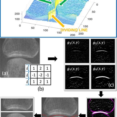 the algorithm flow of joints segmentation a joint image b download scientific diagram