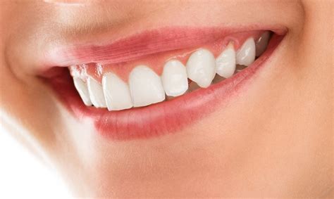 Crown Lengthening Periodontist In Huntington Beach Dr Justin Braga