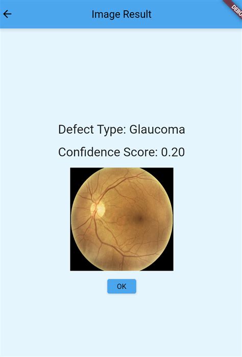 Github Smartinprabhu Fundus Classification A Flutter App In This