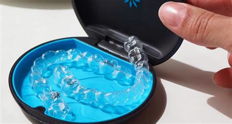 Cómo funciona la ortodoncia invisible o Invisalign