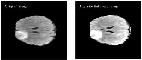 diagnostics free full text deeptumor framework for brain mr image classification