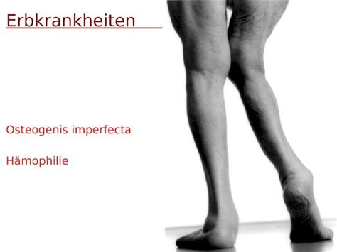 PPT Erbkrankheiten Osteogenis imperfecta Hämophilie Gliederung