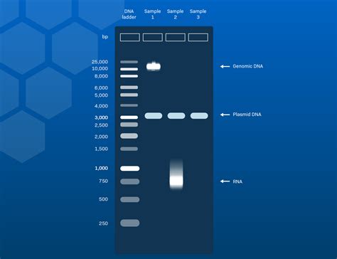 Electrophoresis Results