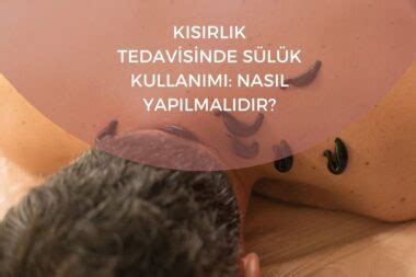 Kısırlık Tedavisinde Sülük Kullanımı Nasıl Yapılmalıdır Kısırlık