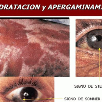 Curso Clasificación de Lesiones y Fenómenos Cadavéricos Academia