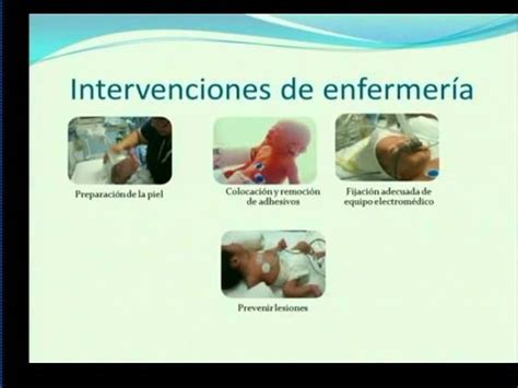 Intervenciones De Enfermeria En La Atencion Del Recien Nacido Prematuro