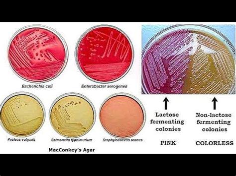 Cled Agar Rationale Uses And Preparation Science
