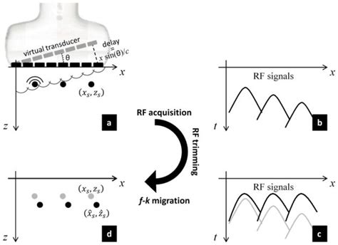 Stolt S F K Migration For Plane Wave Ultrasound Imaging Abstract