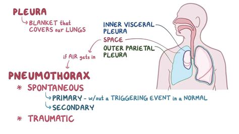 Pneumothorax Video Anatomy Definition Function Osmosis Off