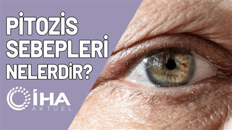 Pitozis Sebepleri Nelerdir YouTube