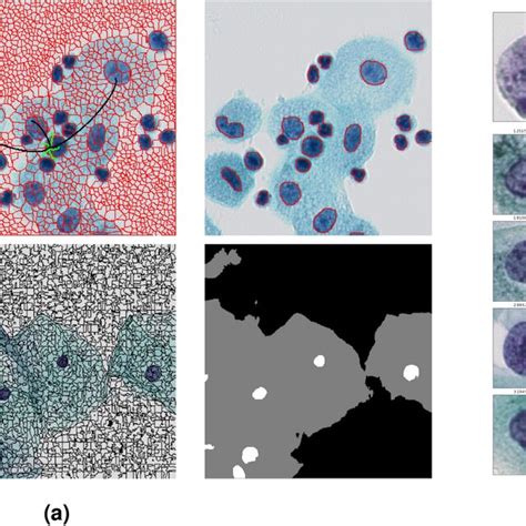 applications in medical imaging a semi supervised segmentation of download scientific