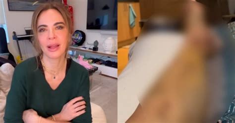 Luciana Gimenez assusta seguidores ao mostrar situação da perna após