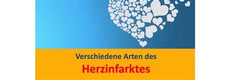 Ein Herzinfarkt Kann Verschiedene Ursachen Haben Cardiopraxis