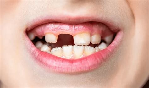 Debunking Common Dental Myths Separating Fact From Fiction MD
