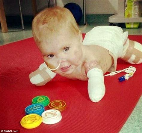 Harmonie Rose Allen Who Lost All Four Limbs To Meningitis Learns To