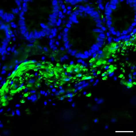 Desmin Antibody Anti Human Reafinity Miltenyi Biotec Usa