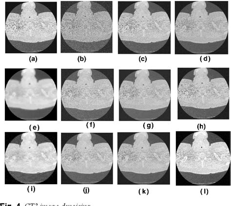 figure 1 from ct image denoising using nlm and correlation based wavelet packet thresholding
