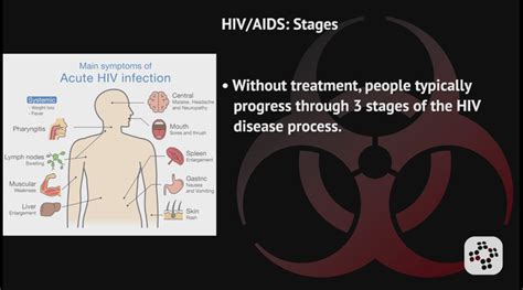 Hivaids Differences Symptoms Stages And Treatment