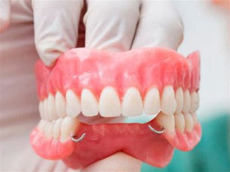 Qu Son Las Pr Tesis Dentales Para Qu Sirven Y Qu Tipos Hay
