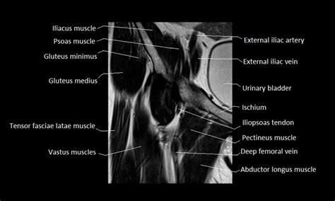 Mri Knee Joint The Best Porn Website