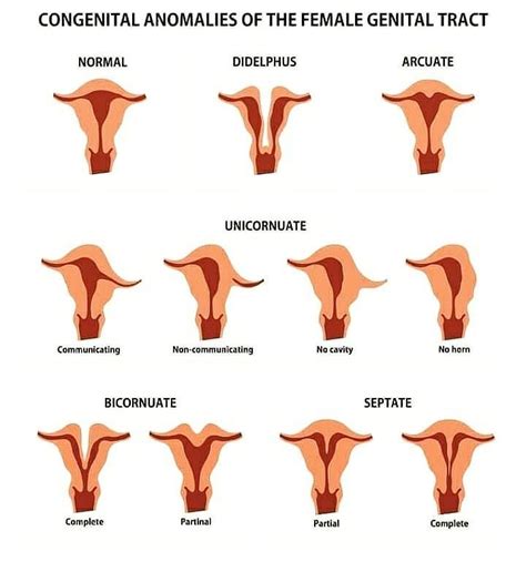 Female Genital Tract In Nursing Notes Medical Ultrasound