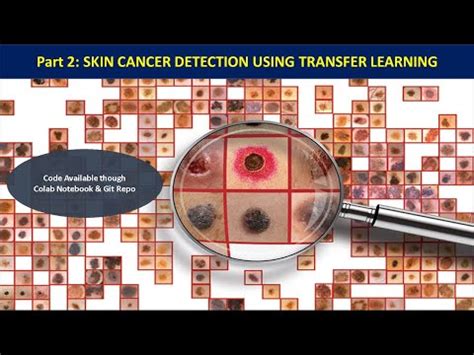 Part 2 Skin Cancer Detection Using Transfer Learning Deep CNN