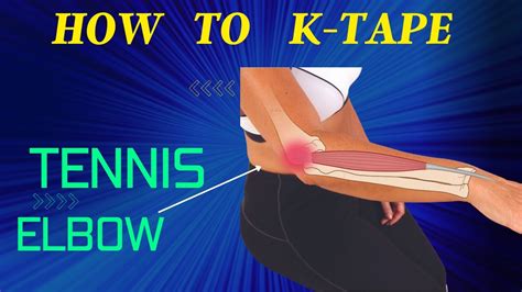 How To Apply Kinesiology Tape For Lateral Epicondylitis Tennis Elbow