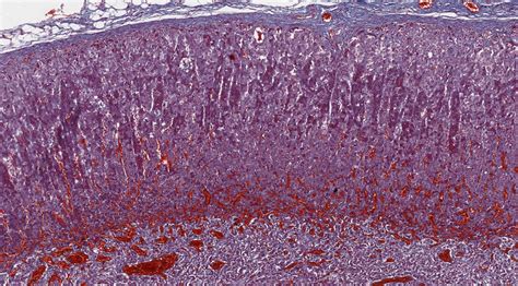 Adrenal Gland Histology Labeled