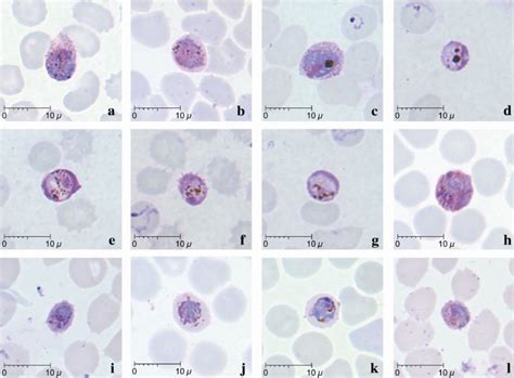 Morphological Features And Differential Counts Of Plasmodium Knowles I