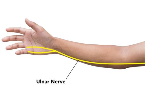Ulnar Nerve X Ray