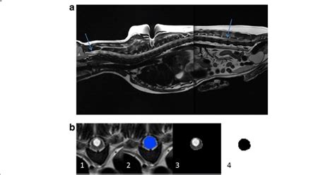 A T2 Weighted Mid Sagittal MRI Of A CKCS Suffering From A Large Syrinx