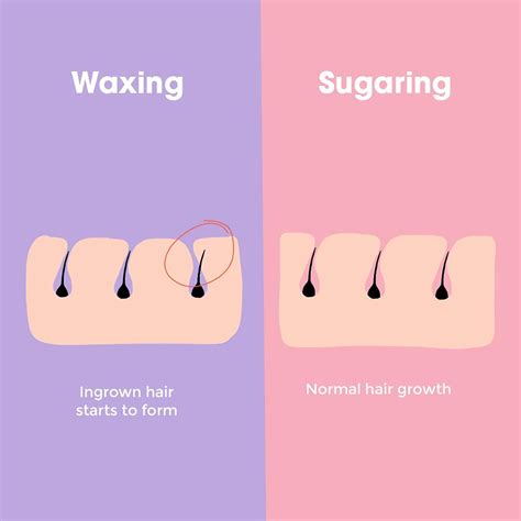 Brazilian Bikini Sugaring Paste Professional Sugar Wax By Sugaring Nyc Medium Includes