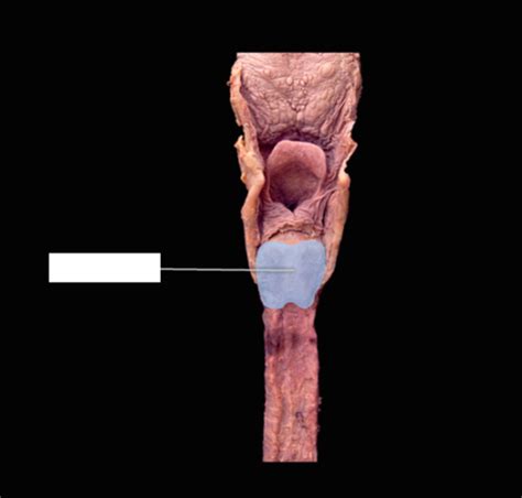 Respiratory System Cadaver Flashcards Quizlet