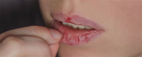 Labios secos y agrietados Cómo cuidarlos para evitarlo Blog Druni