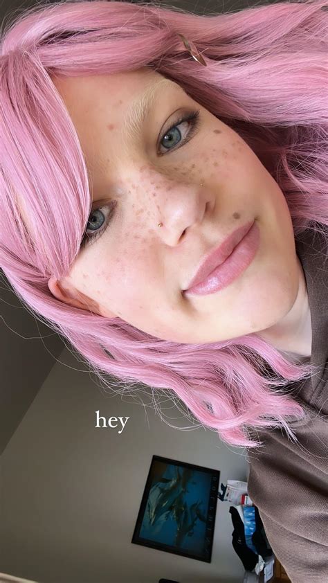 438 Best U Infamous Albino Images On Pholder Freckled Girls