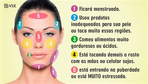 O Que Os Lugares Do Rosto Onde Surgem E Tipos De Espinhas Dizem Sobre