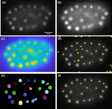 denoising and nuclei detection with the sparse representation model download scientific
