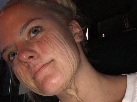 Teen Nude Spray Tan Telegraph