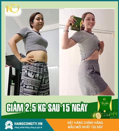 Nio Slim Kẹo Gôm Giảm Cân Chính Hãng Hộp 15 Gói
