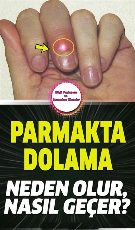 Parmakta Olu An Dolama Nas L Ge Er Neden Olur Lezzetli Sunumlar Sitesi